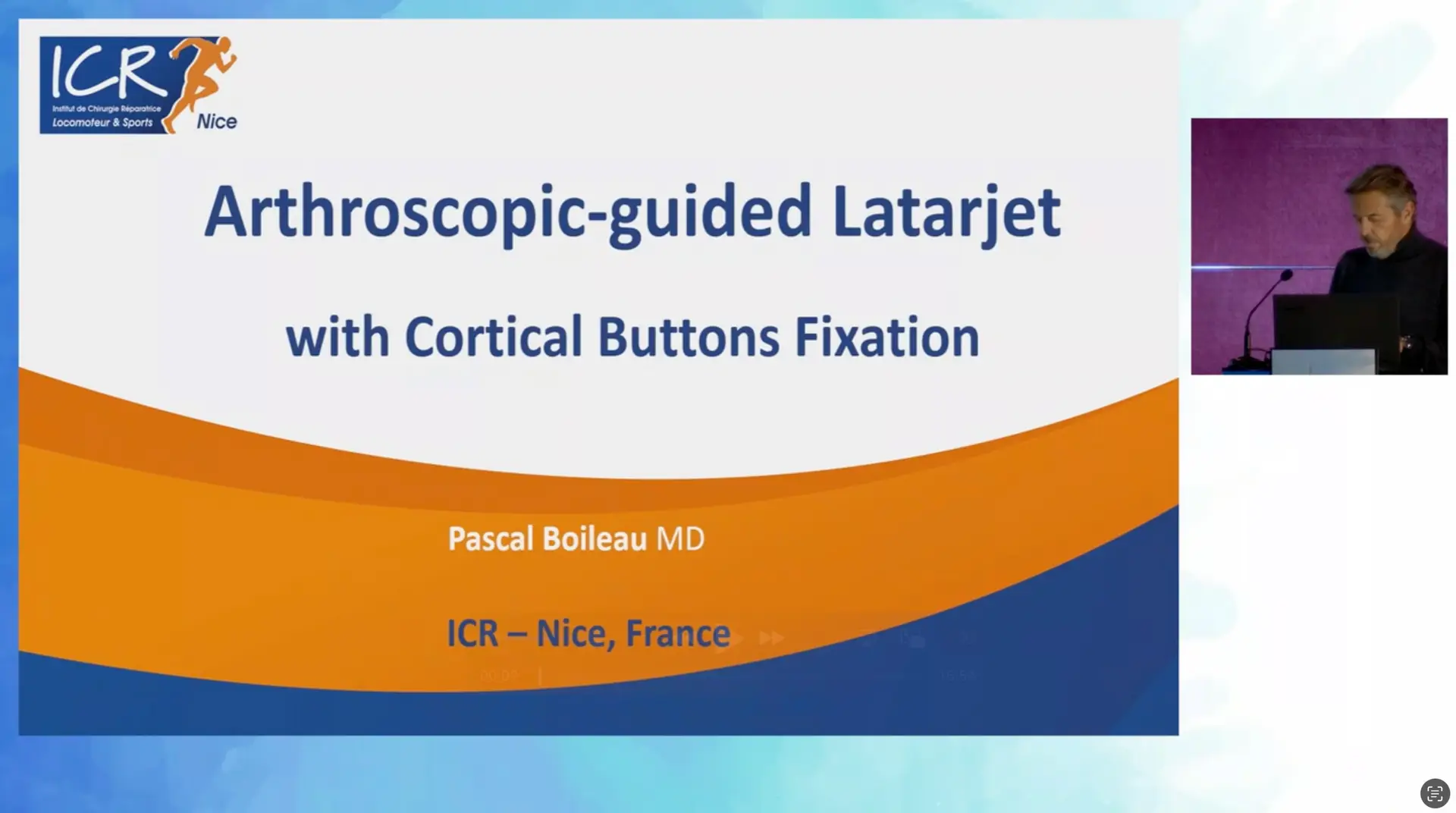 Arthroscopic-Guided Latarjet With Cortical Buttons Fixation - Nice ...